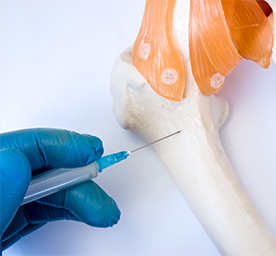 Biopsja aspiracyjna - Integrative Medical Center